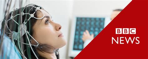 Bbc News Tacs Brain Stimulation Boosts Memory Alzheimers Clinics