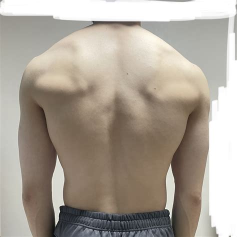 등근육 불균형 자세 피드백 해주세요 ㅠㅠ 사진 추가 몬스터짐