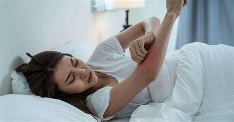 Cholestasis Symptoms Heres What To Look For