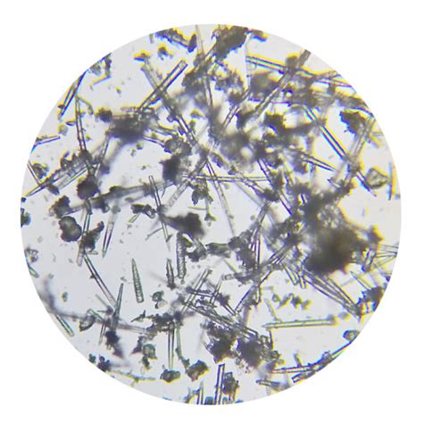 Hydrolyzed Sponge 70 Diolabspicule