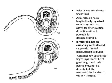 Finger Tip Injuries And Management Pptx First Aid Injuries