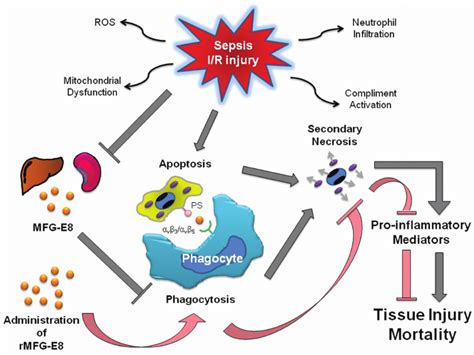 Sepsis Pathophysiology Diagram