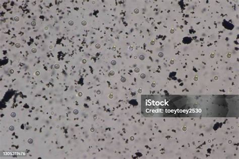 Cryptococcus Neoformans Is An Encapsulated Fungal Organism And It Can