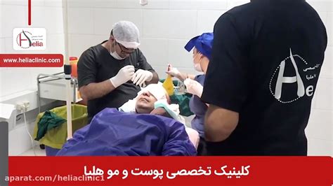 کاشت مو به روش میکروگرافت کلینیک هلیا 02179547 شماره 38