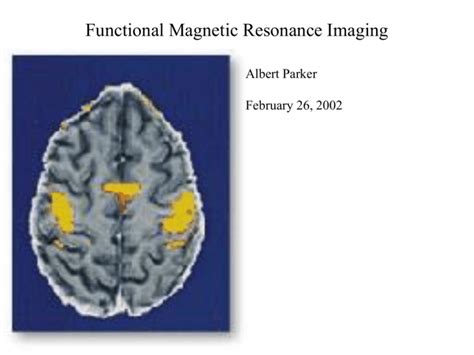 Functional Magnetic Resonance Imaging