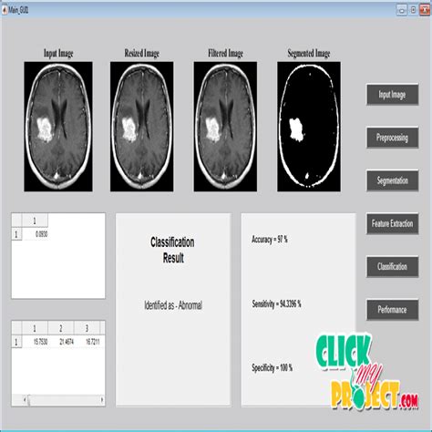 Brain Tumor Classification Using Deep Cnn Clickmyproject