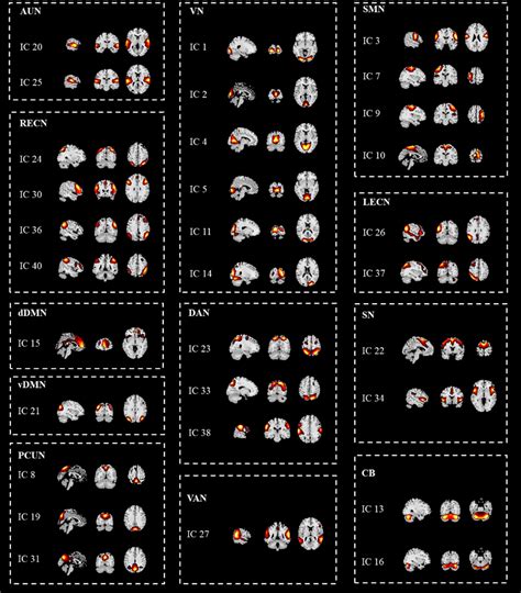 Spatial Maps Of The 31 Intrinsic Connectivity Networks Icns The 31 Download Scientific