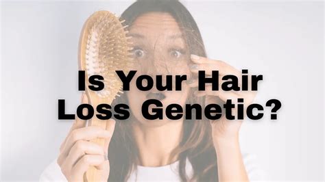 Is Your Hair Loss Genetic And Its Not About Baldness Genetic Education