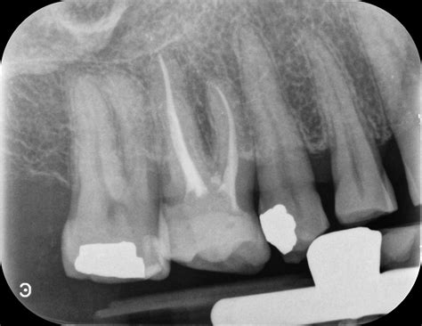 Cs 7200 } Carestream Dental