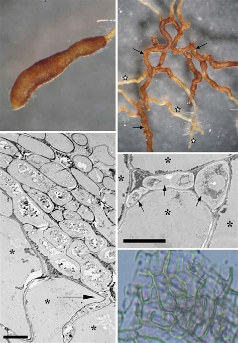 Mycorrhizae Microscope