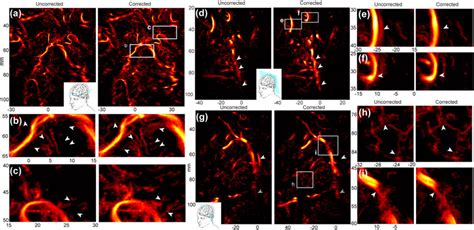 Examples Of Microbubble Localization Images Obtained Without Left And Download Scientific