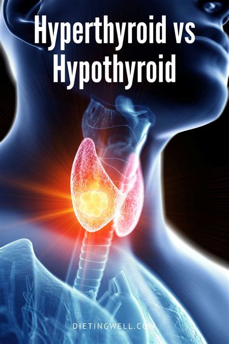 Thyroid Levels Artofit