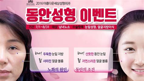 아름다운세상성형외과 동안성형이벤트 Youtube