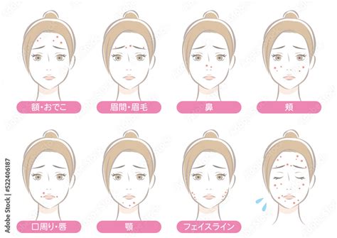 顔のニキビの出来やすい場所女性 Stock ベクター Adobe Stock