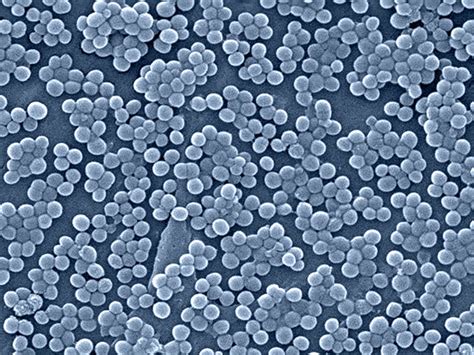 Mrsa Symptoms What They Are Causes Treatment And More