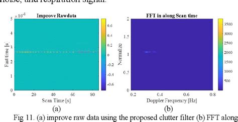 Figure 11 From Ir Uwb Generate By Fpga For Non Contact Respiration Measurements Semantic Scholar