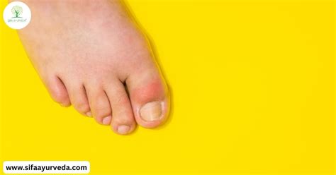 Best Effective Way How To Control Uric Acid In Body Sifa Ayurveda