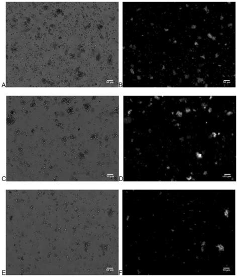 Facile Functionalization Of Ag Sio2 Core Shell Metal Enhanced Fluorescence Nanoparticles For
