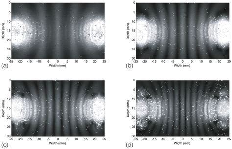 Shear Wave Interference Patterns For Acoustic Radiation Force Download Scientific Diagram