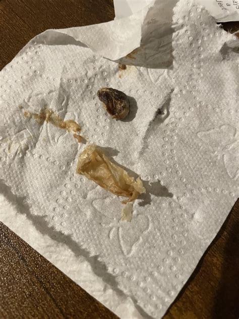 Some Ear Extraction From Last Night Rpopping