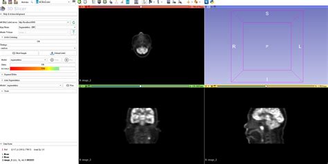 Path Location For Best Model Storage · Project Monai Monailabel