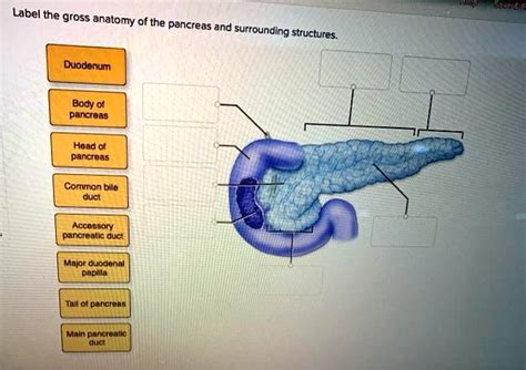 Get Answer Label The Gross Anatomy Of The Pancreas And Surrounding