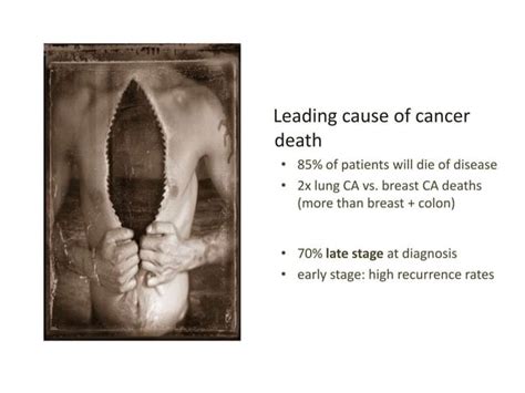 Nsclc Management Basics Pptx