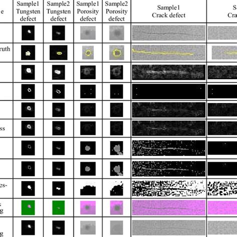 Results Obtained From Various Segmentation Techniques Download Table
