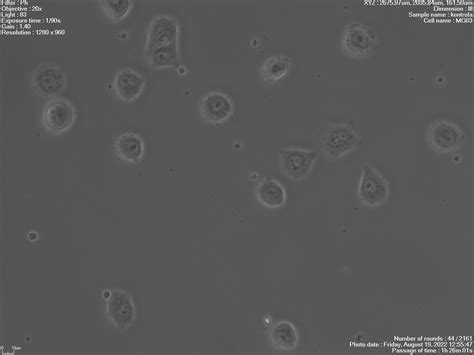 Mg63 Cell Detection Object Detection Dataset By Aligaterr