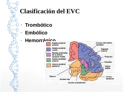 Enfermedad Vascular Cerebral 2018