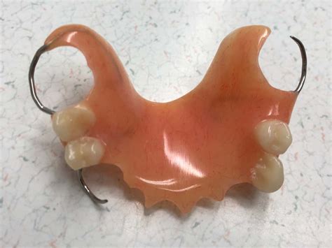 Denture Adjustments For Sore Spots And Pain Services At Grantham