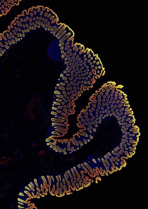 E Cadherin And β Catenin Interactions Navinci