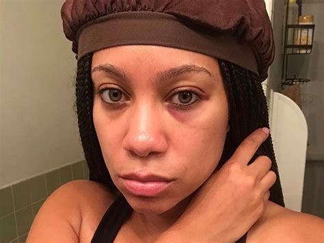 Dray Clarks Girlfriend Comes Forward About Domestic Violence In