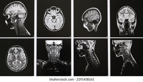 19 364 Brain Structure Concept Images Stock Photos Vectors Shutterstock