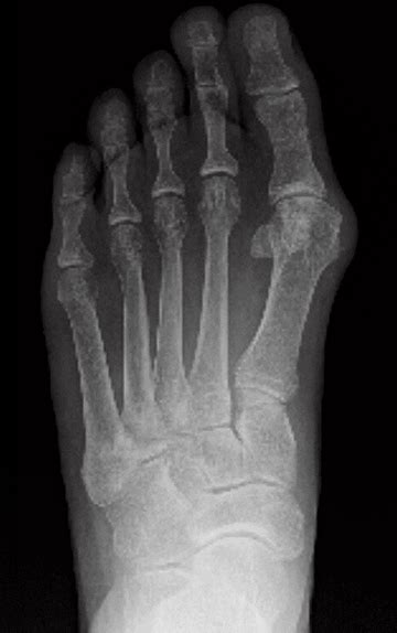 The Lapiprep System Lapidus Your Way Not Theirs