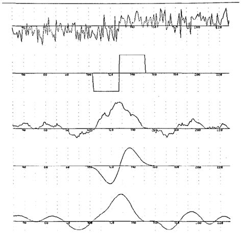 边缘提取 论文解析 知乎