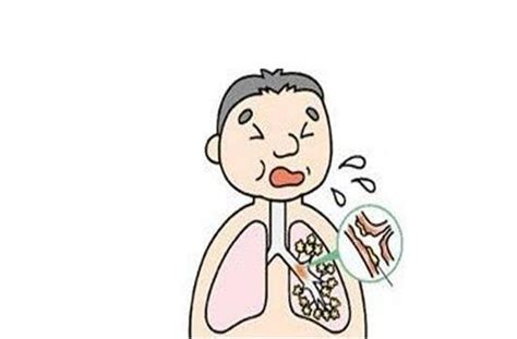 慢性支气管炎又犯了 咋整 教你用银耳桔梗煮水来缓解 致病