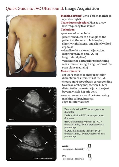 Quick Guide Ivc Ultrasound