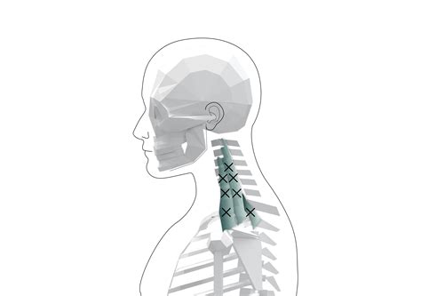 Scalenus Trigger Points Overview And Tips For Self Treatment