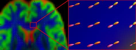 Mrtrix Introduction Overview Of Diffusion Imaging — Andys Brain Book 10 Documentation