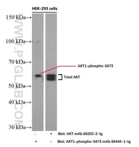 P70s6k Antibody 14485 1 Ap Proteintech 武汉三鹰生物技术有限公司