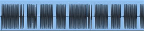 Crackling Sound Related To Sample Rate · Pschatzmann Arduino Audio Tools · Discussion 947 · Github