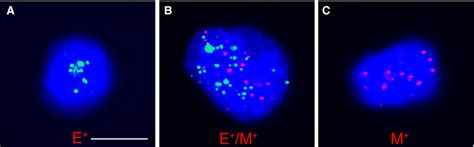 Three Epithelial‐mesenchymal Transition Subtypes Of Circulating Tumor Download Scientific