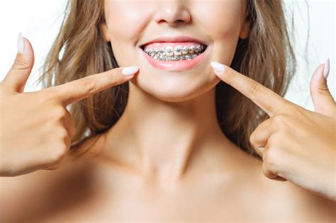 Swollen Gums With Braces