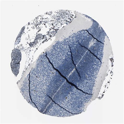 Tissue Expression Of Pparg Staining In Placenta The Human Protein Atlas
