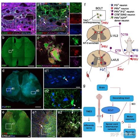 重磅研究！尾神经电刺激联合类脊髓组织移植促进脊髓损伤大鼠功能恢复 知乎