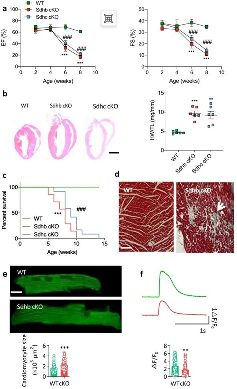 Basic Res Cardiol 北京大学未来技术学院程和平 马淇课题组揭示琥珀酸脱氢酶调控心脏功能的分子机制 Medsci Cn