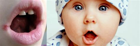 ¿como Curar Las Boqueras Adios Queilitis Angular Como Curar La