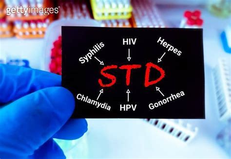 STD Sexually Transmitted Disease Term HIV Syphilis Herpes HPV Chlamydia Gonorrhea STDs