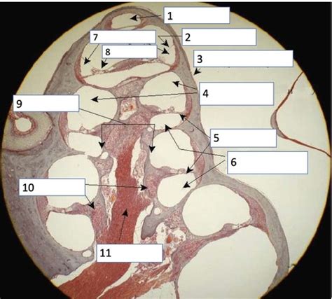 Cochlear Cross Section Flashcards Quizlet